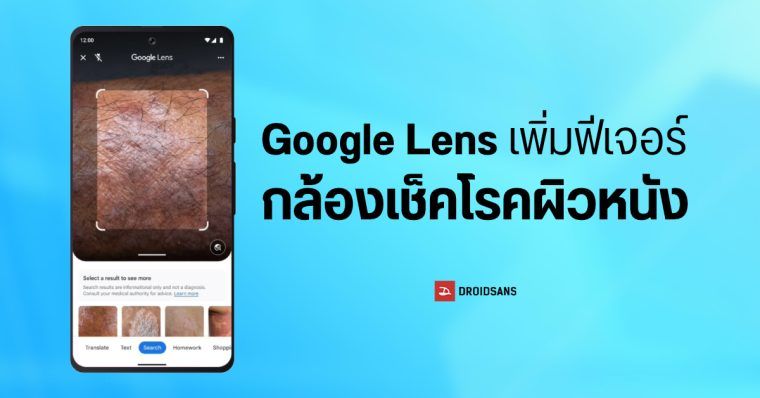 Google Lens เพิ่มสกิล ใช้กล้องส่องโรคผิวหนังเพื่อเช็คว่าเป็นอะไรกันแน่ | DroidSans